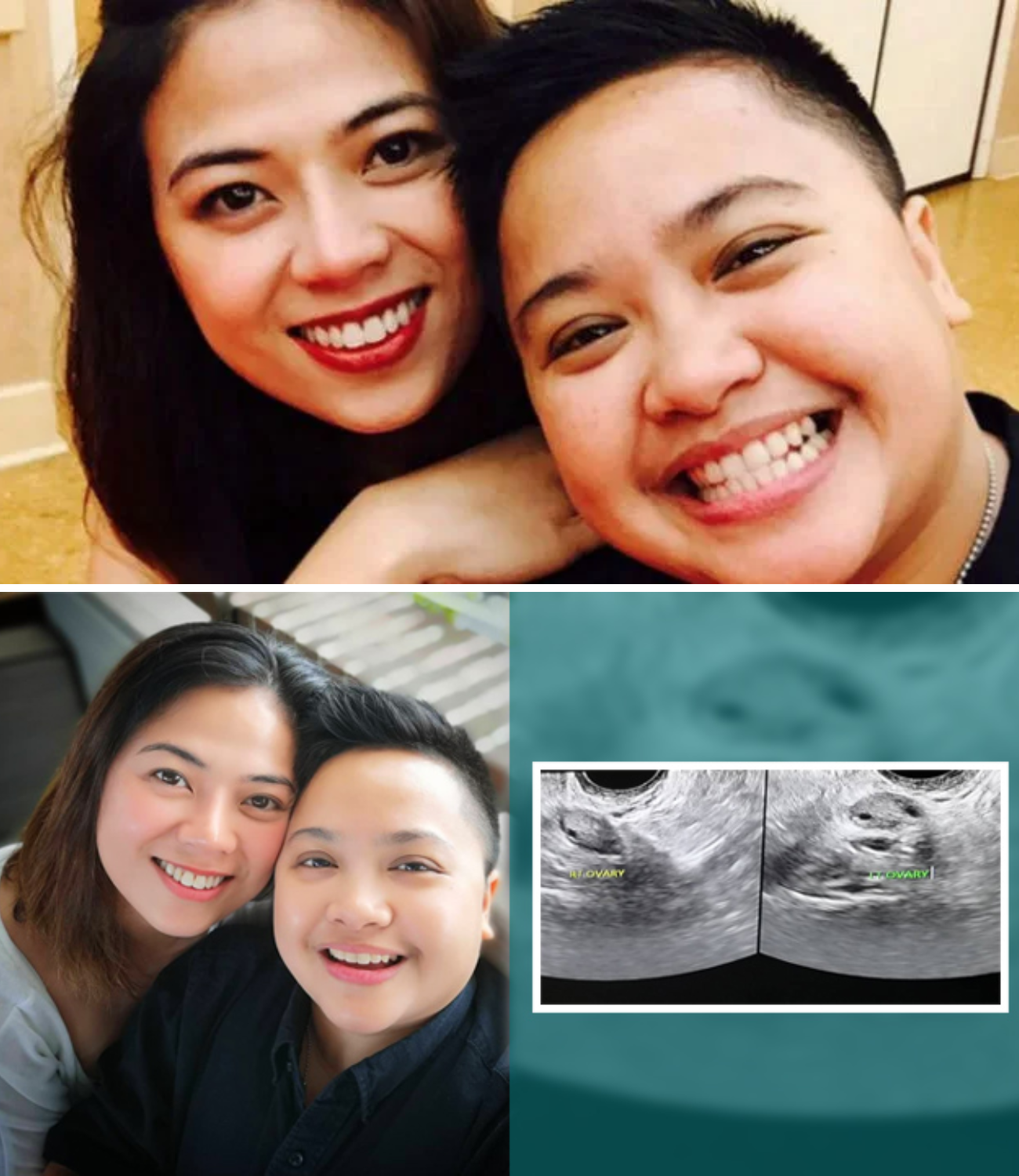 SHOCKING REVEAL: Ice Seguerra Finally Names the Actor Who Donated His ...