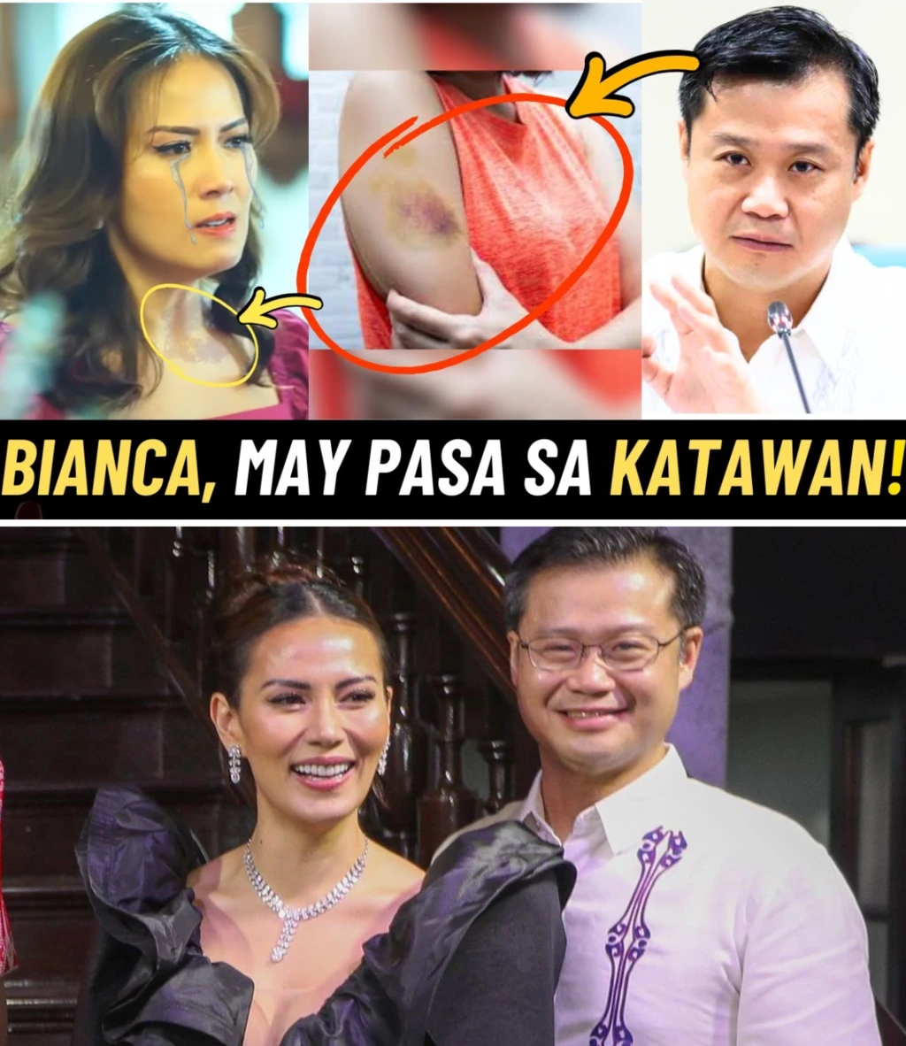 SHOCKWAVE IN SHOWBIZ: Bianca Manalo Allegedly Assaulted by Senator Win ...