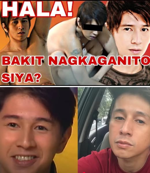 FORMER HEARTTHROB TURNED BOLD STAR — Here’s What Happened to Sherwin ...